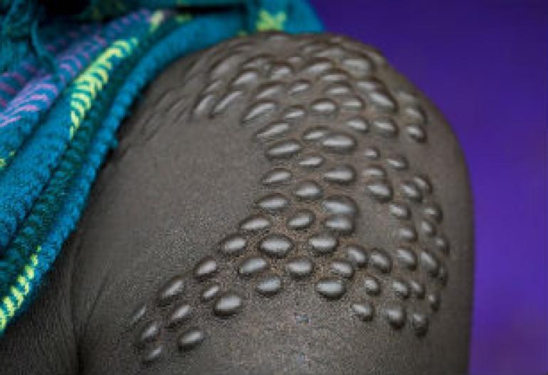 Ethiopian and Sudanese tribes show off tattoos created using thorns